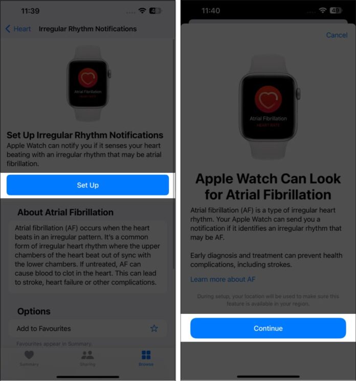 How to use ECG on Apple Watch: A complete guide - iGeeksBlog
