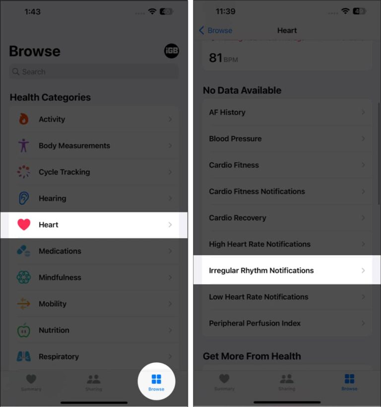 How to use ECG on Apple Watch: A complete guide - iGeeksBlog