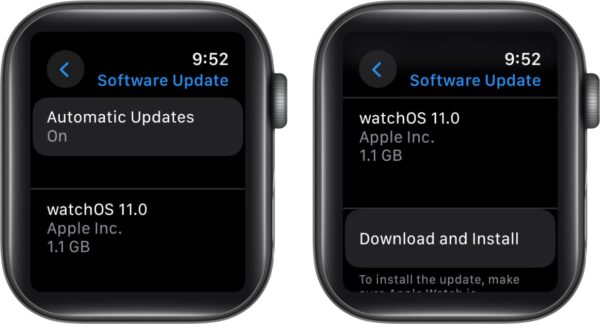 How to Update Your Apple Watch to watchOS 26 - iGeeksBlog
