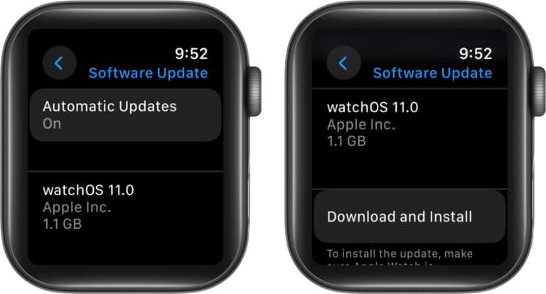 How to Update Your Apple Watch to watchOS 26 - iGeeksBlog