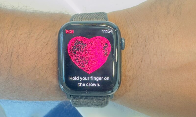 ECG not working on your Apple Watch? Here's how to fix it - iGeeksBlog